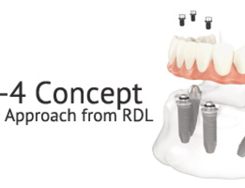 ASC Abutment - RDL - A Full Service Dental Lab