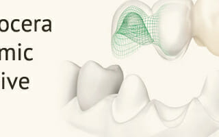 Crown & Bridge Archives | RDL | Russellville Dental Lab