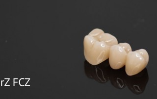 Crown & Bridge Archives | RDL | Russellville Dental Lab