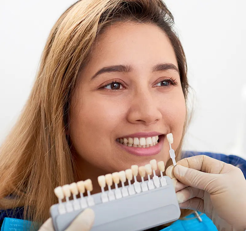 Tips for Shade Taking - RDL - A Full Service Dental Lab