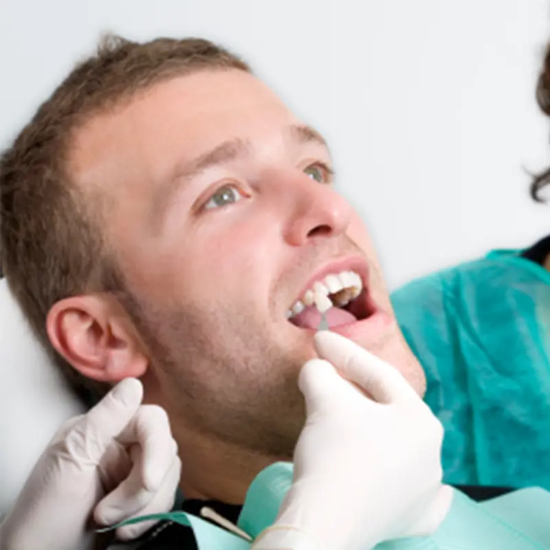 Tips for Shade Taking - RDL - A Full Service Dental Lab